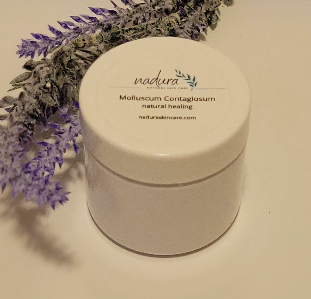 Molluscum Contagiosum Salve (Water Warts) | Nadura Skin Care